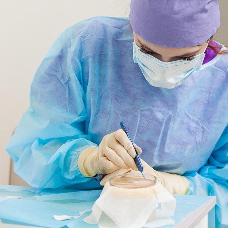 Eyebrow Transplant In Turkey's Best Clinic | Lenus Clinic