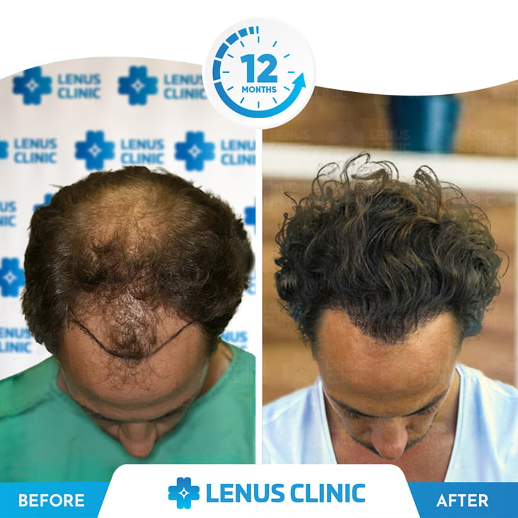 Results - Lenus Clinic