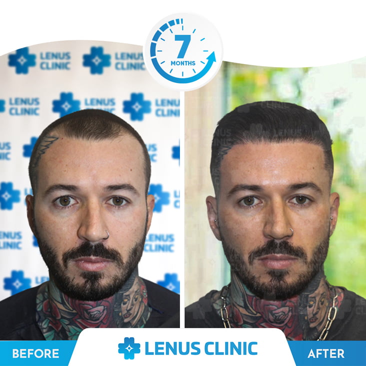 Results - Lenus Clinic